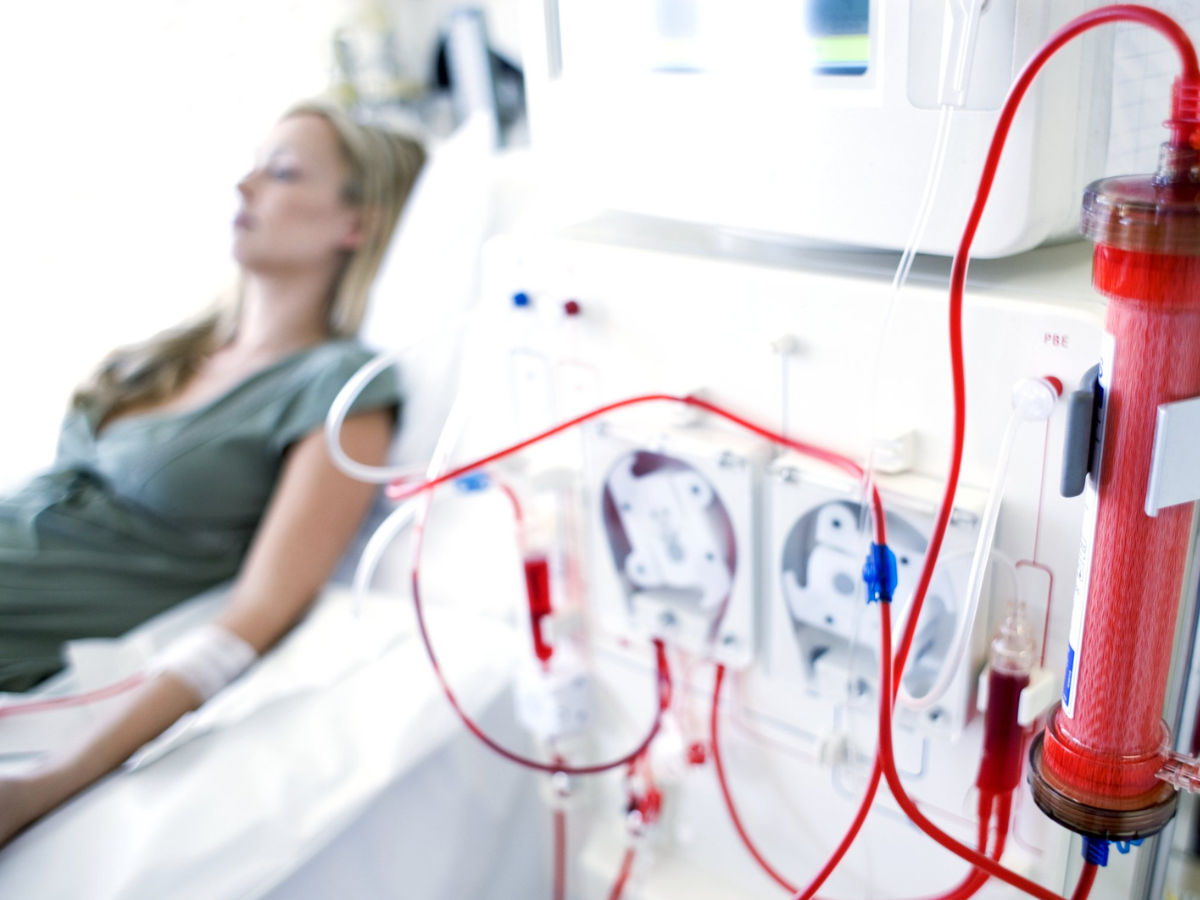 Understanding Dialysis and Its Impact on Life Expectancy - Responsum Health