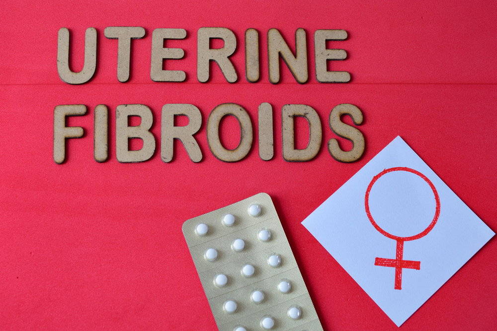 Non-Surgical Treatments for Uterine Fibroids | Responsum Health